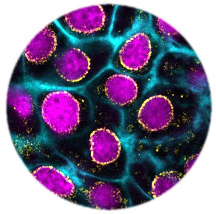 Heath Lab: Exploring Zebrafish Model for Cancer Targets | WEHI