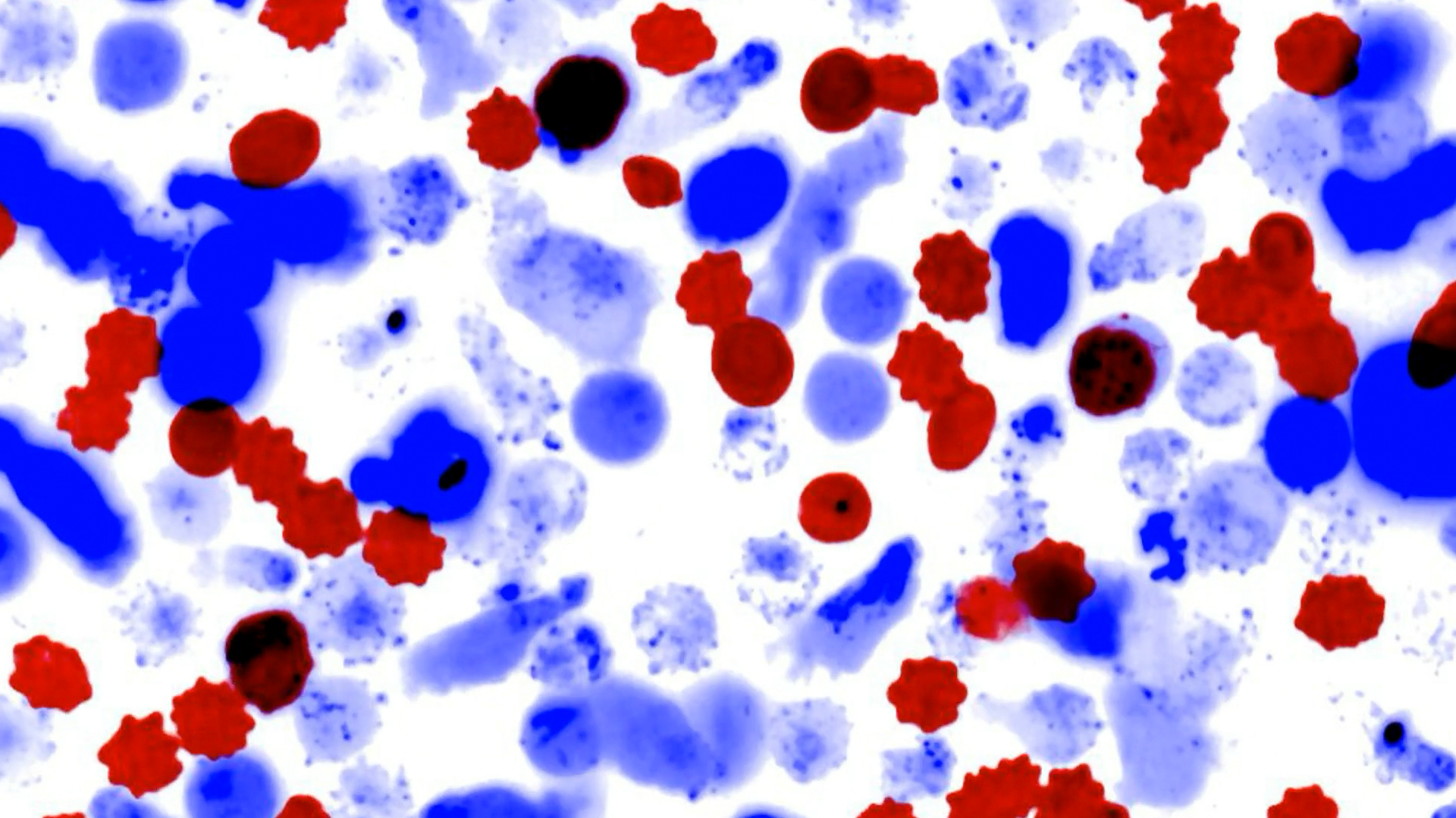 Art of Science: Natural Born Killers | WEHI