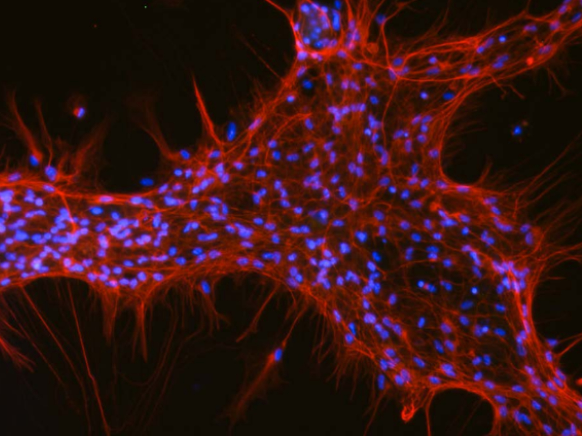 2023 Exhibition Archives | WEHI