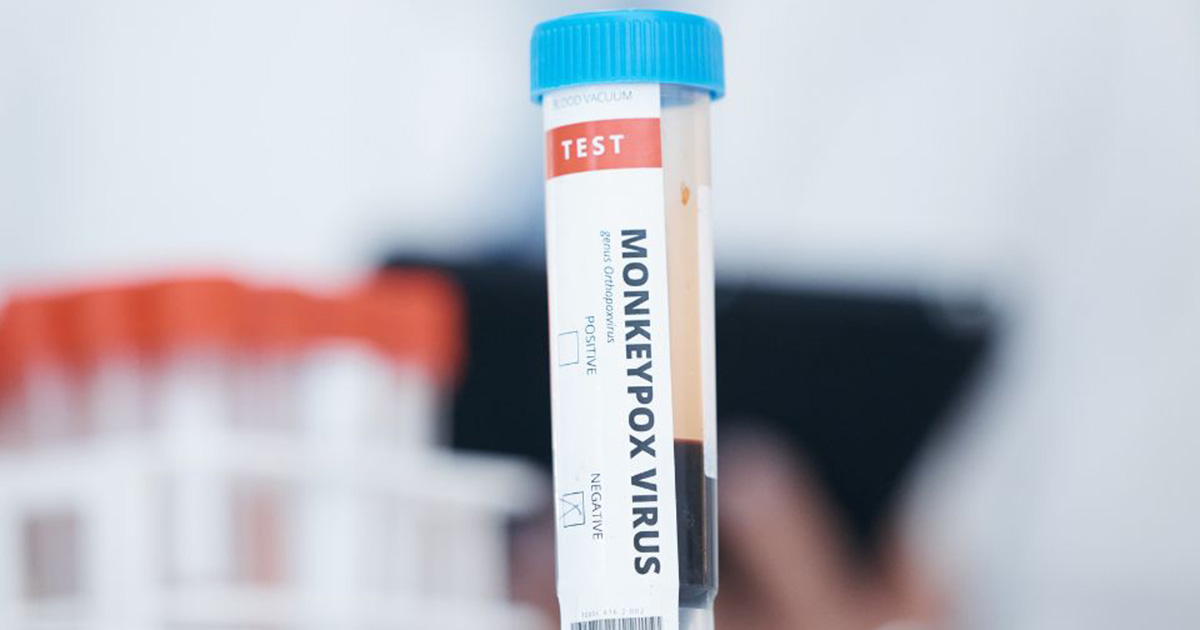 Unveiling Australia’s fastest next-gen mpox diagnostic tool | WEHI