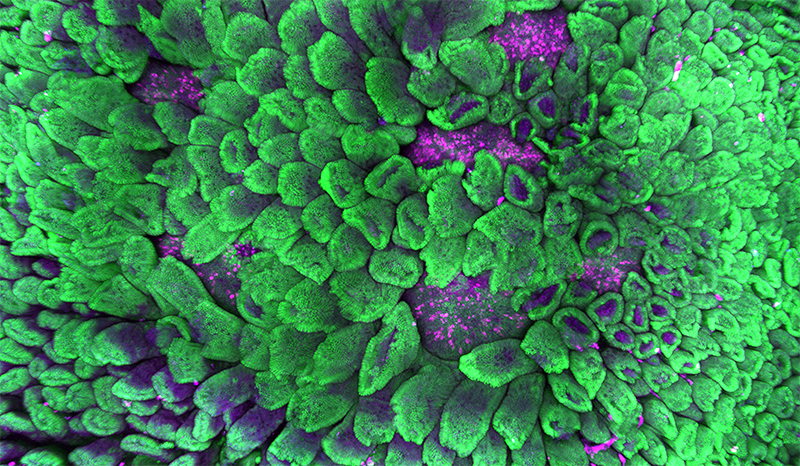 Snow Centre for Immune Health | WEHI