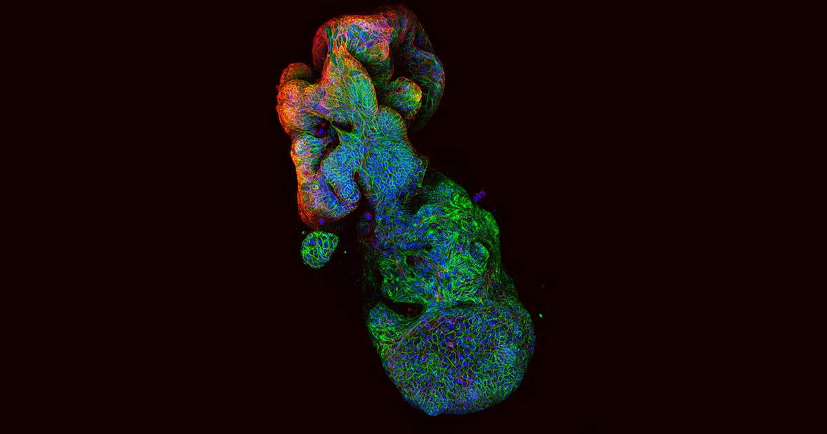 Lab-grown tumours predict treatment outcomes in landmark study | WEHI