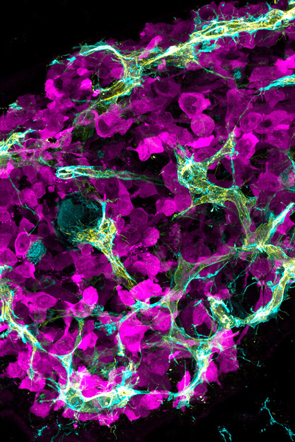 Zeiss LSM 880 NLO Fast Airyscan Confocal | WEHI Zeiss LSM 880 NLO Fast Airyscan Confocal | WEHI