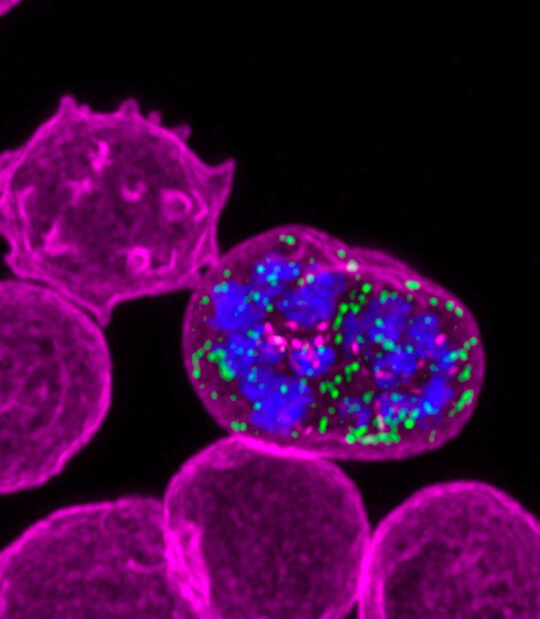 Zeiss LSM 880 NLO Fast Airyscan Confocal | WEHI Zeiss LSM 880 NLO Fast Airyscan Confocal | WEHI