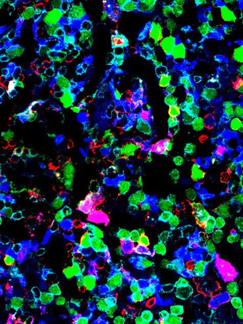 Zeiss LSM 880 NLO Fast Airyscan Confocal | WEHI Zeiss LSM 880 NLO Fast Airyscan Confocal | WEHI