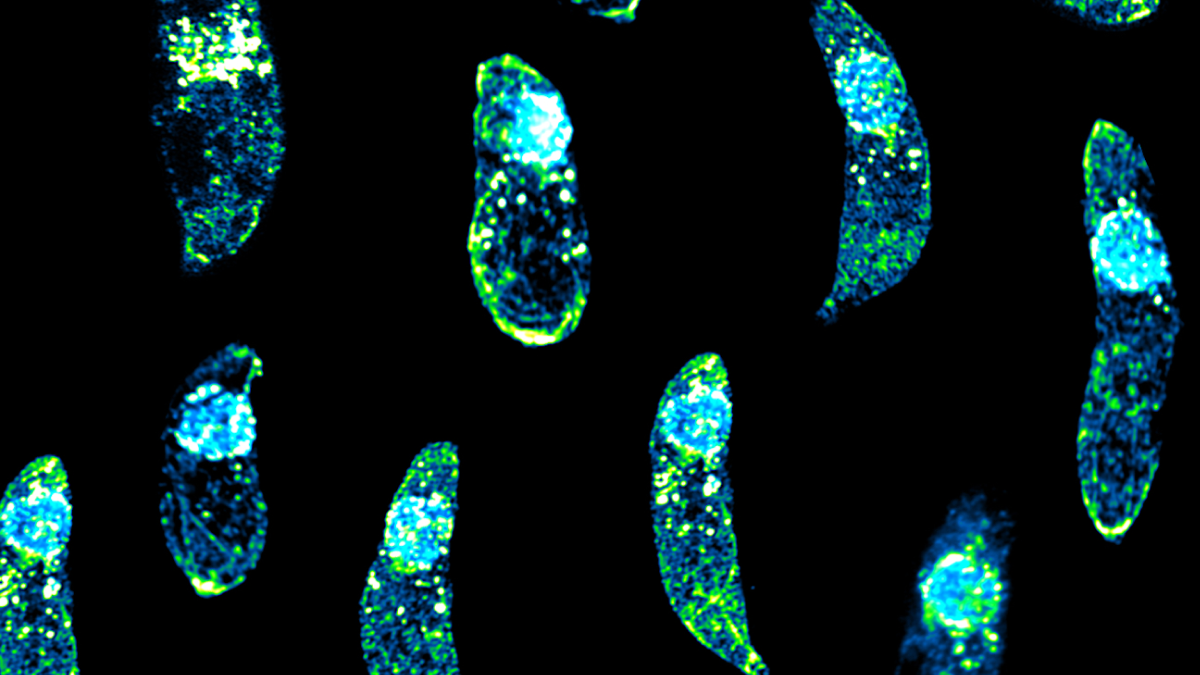 Walter and Eliza Hall Institute of Medical Research | WEHI