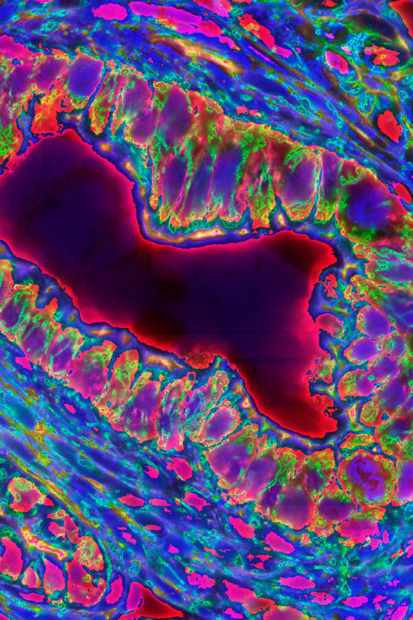 Zeiss LSM 880 NLO Fast Airyscan Confocal | WEHI Zeiss LSM 880 NLO Fast Airyscan Confocal | WEHI