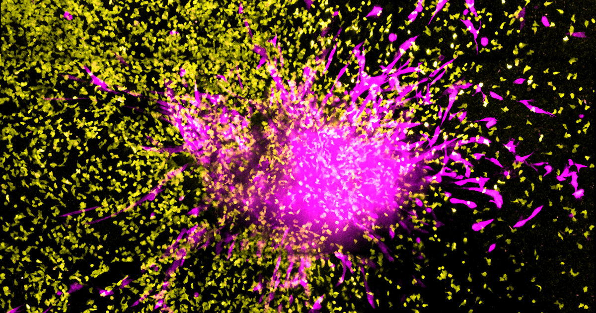 Two-in-one breakthrough: Cutting-edge immunotherapy could hold promise ...
