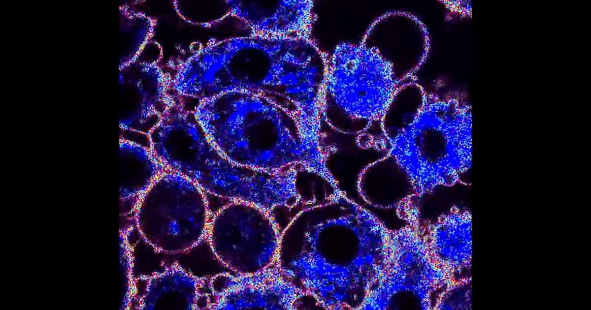 Art of Science: Poised to Rupture | WEHI