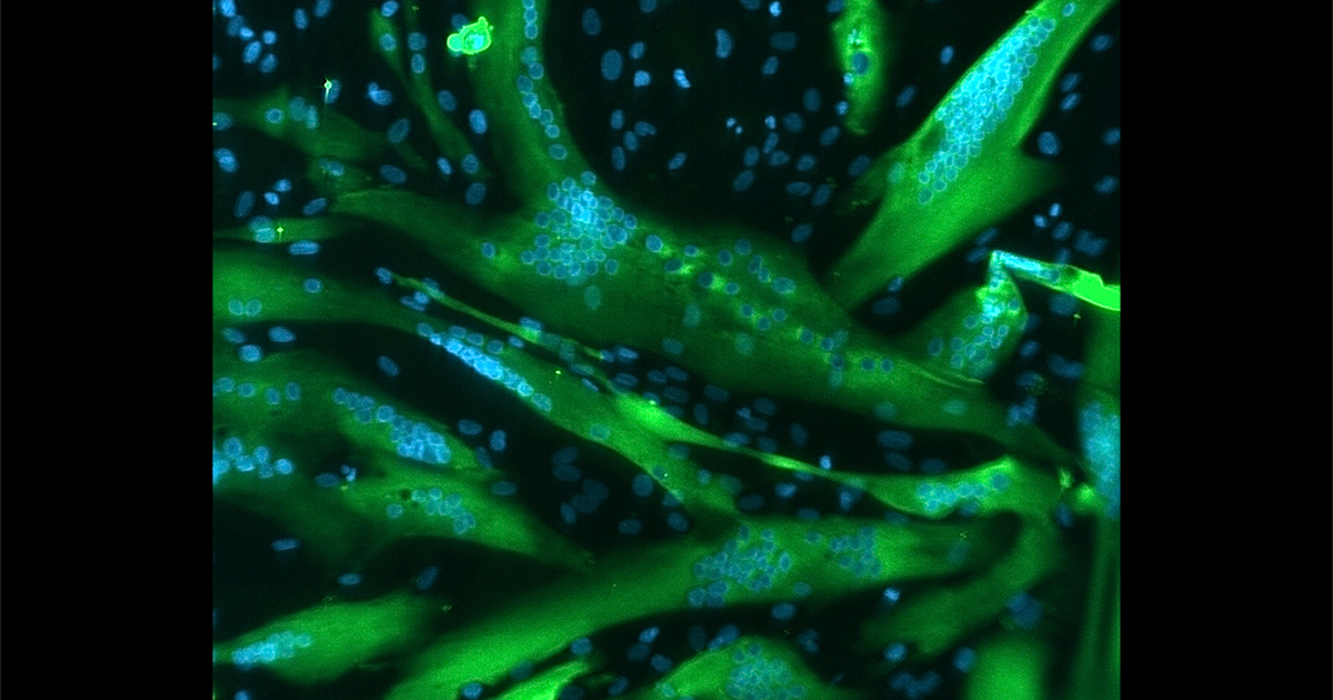 2024 Exhibition Archives | WEHI