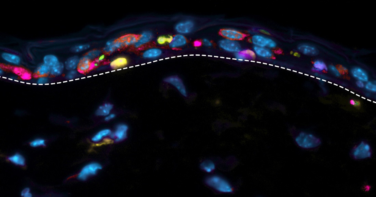 World-first cure for lethal skin disease achieved in landmark study | WEHI