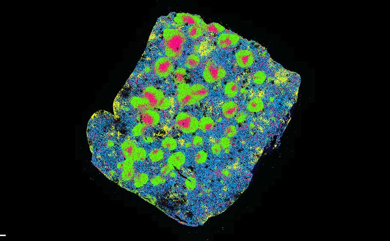 Spatial Omics Research And Insights Wehi