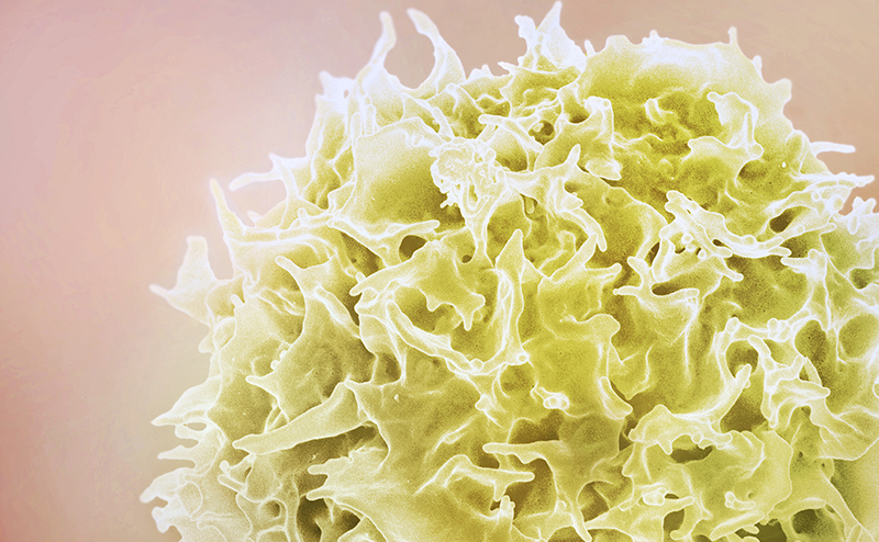 Study identifies world-first treatments to prevent a life-threatening ...