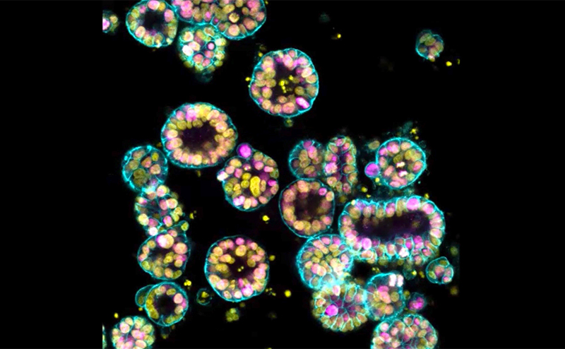 Are chemicals to blame for cancer in young people? Here’s what the ...